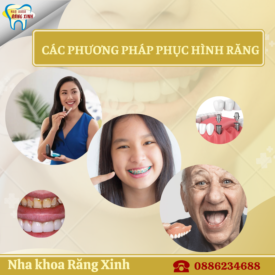CÁC PHƯƠNG PHÁP PHỤC HÌNH RĂNG. Nha Khoa Răng Xinh