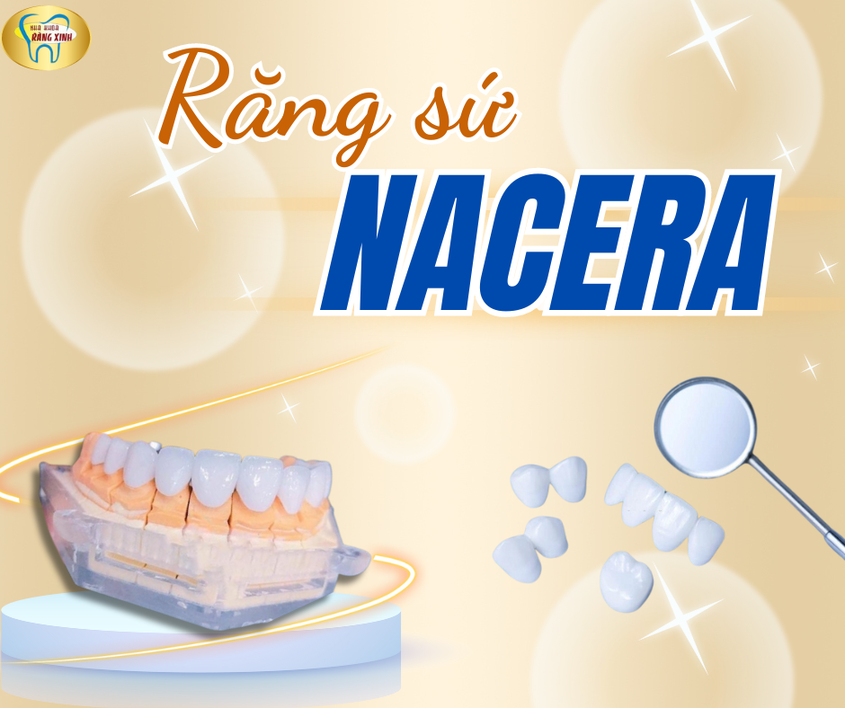 RĂNG SỨ NACERA VÀ NHỮNG THÔNG TIN CẦN BIẾT KHI...