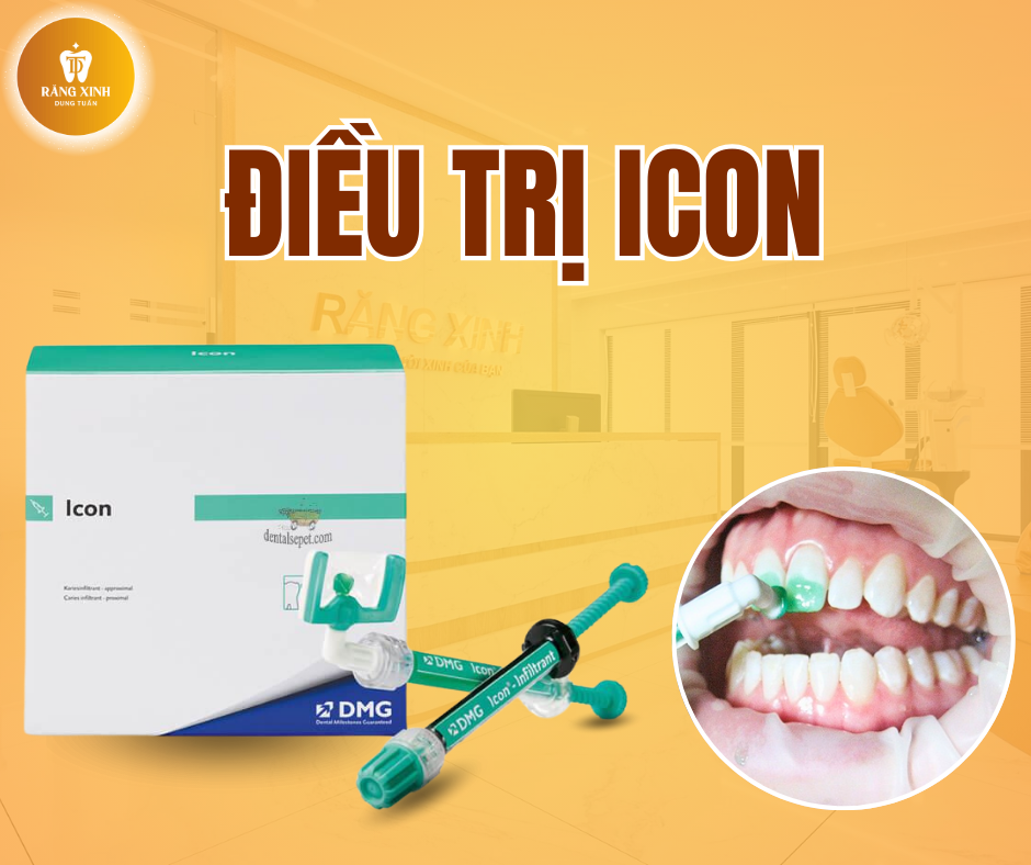 ĐIỀU TRỊ ICON : GIẢI PHÁP XỬ LÝ ĐỐM TRẮNG TRÊN RĂNG