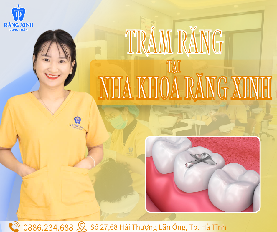Dịch vụ trám răng tại Nha Khoa Răng Xinh có gì nổi bật?